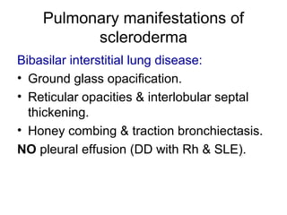 Scleroderma | PPT