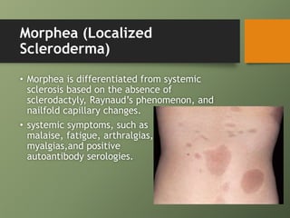 Scleroderma | PPTX