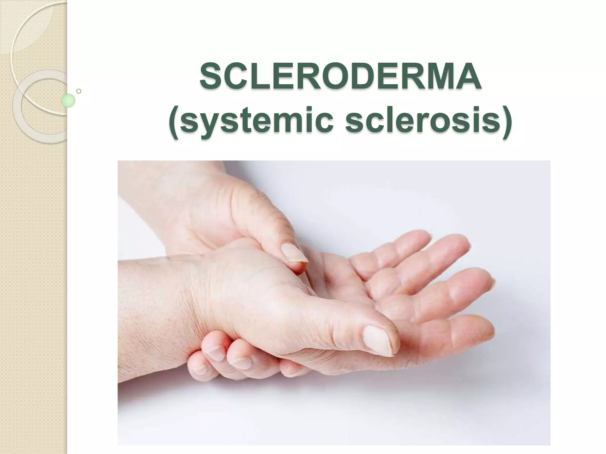 scleroderma-191009073259 (1).pdf