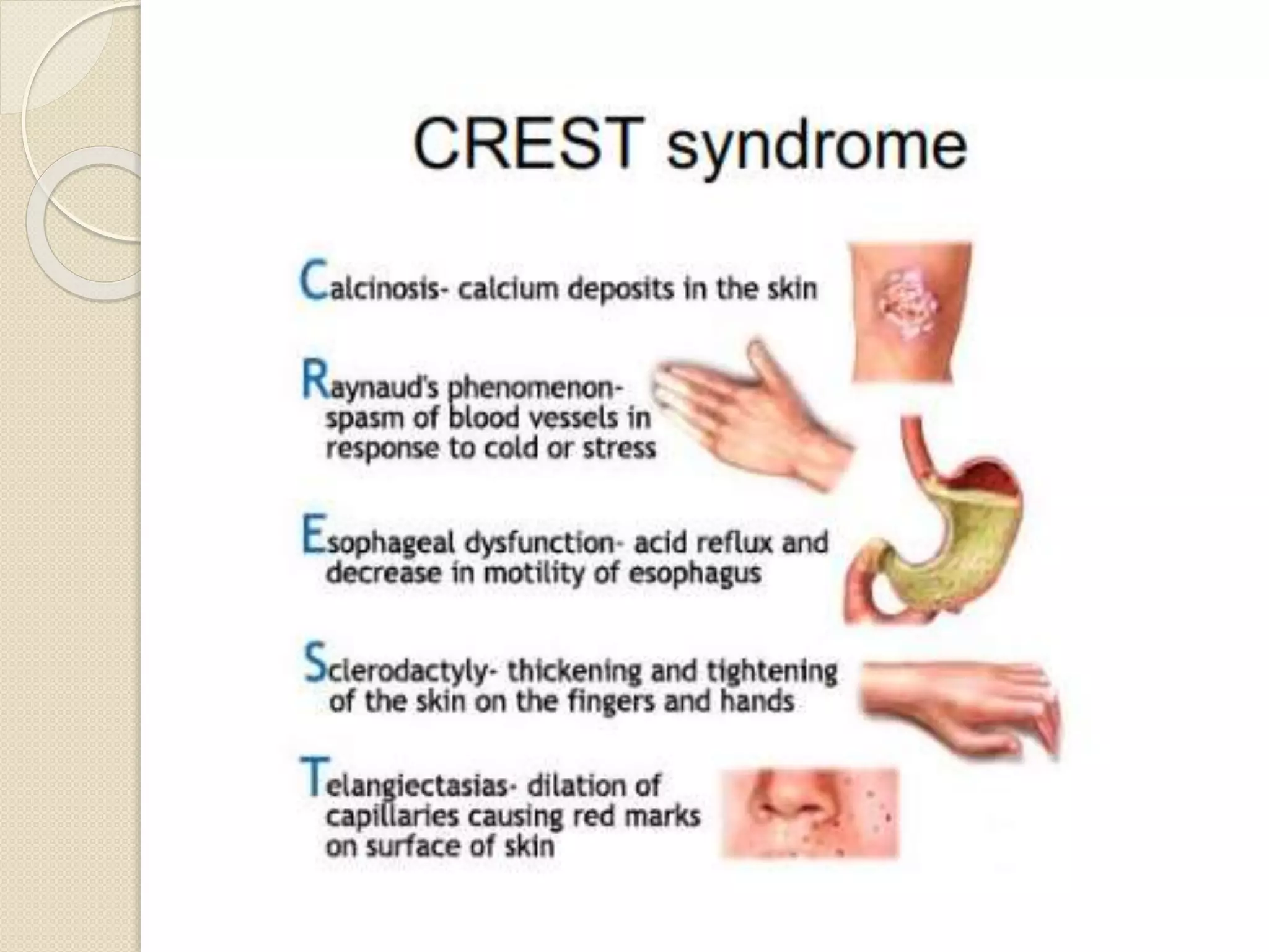 scleroderma-191009073259 (1).pdf