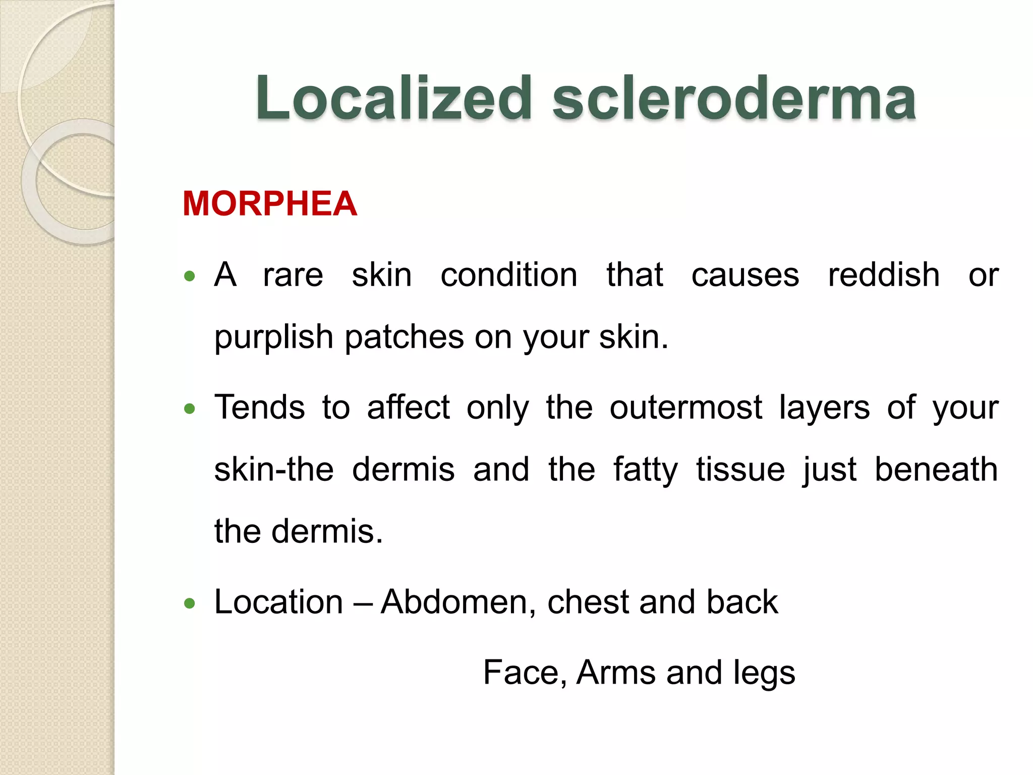 scleroderma-191009073259 (1).pdf