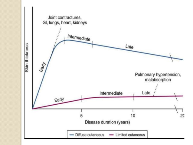 scleroderma-191009073259 (1).pdf