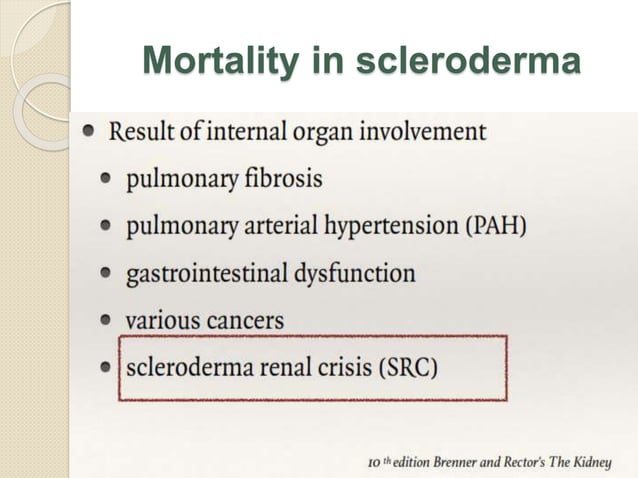 scleroderma-191009073259 (1).pdf
