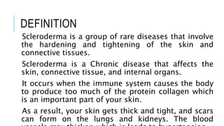 Scleroderma | PPT | Free Download