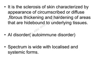 Scleroderma | PPTX