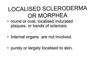 Scleroderma | PPTX