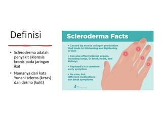 Scleroderma.1.pptx