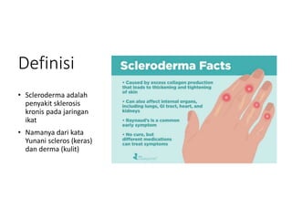 Scleroderma.1.pptx