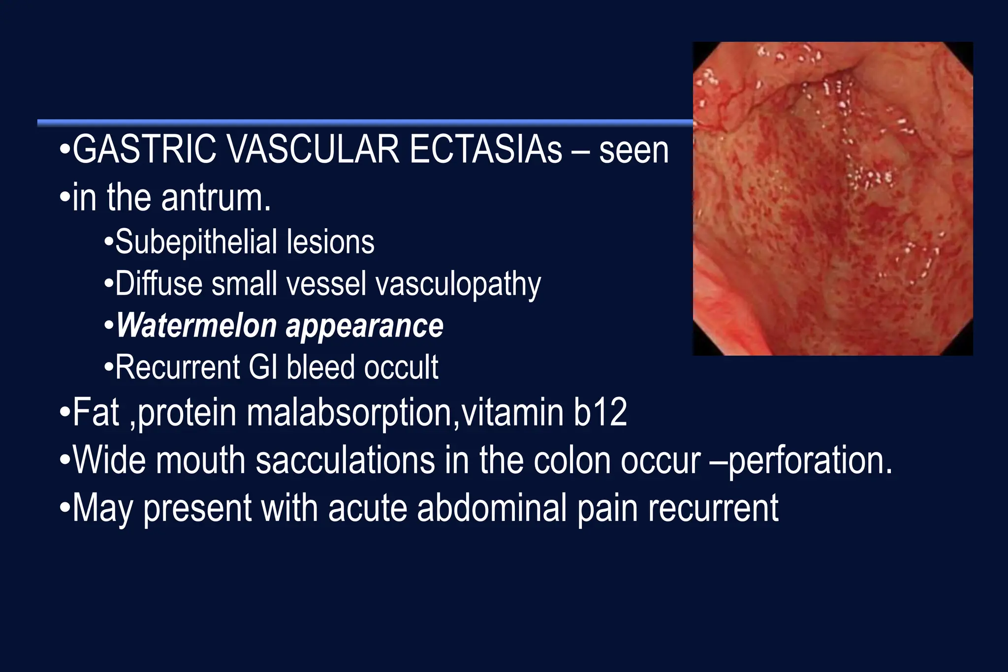 scleroderma disease - connective tissues | PPTX