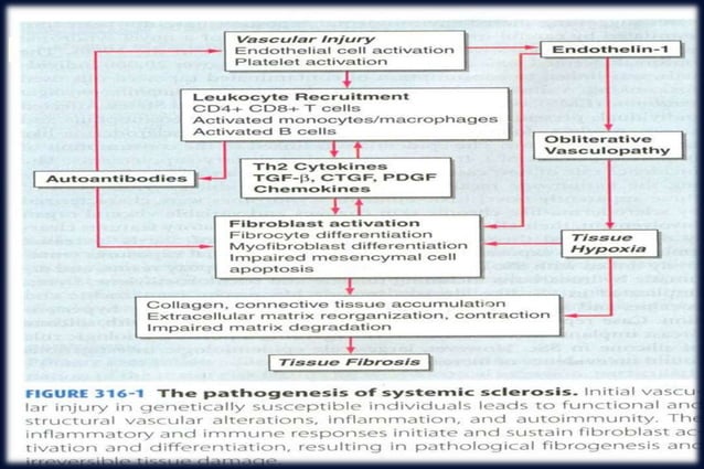 scleroderma disease - connective tissues | PPTX | Skin and Dermatology ...