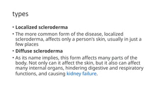 Scleroderma.pptx skin infection scleroderma | PPTX