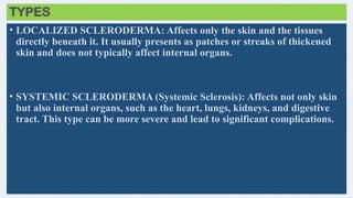 SCLERODERMA medical surgical nursing I, GNM 2nd Year.pptx