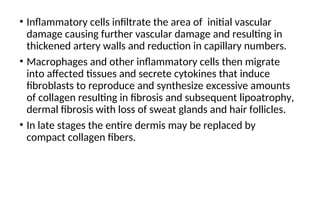 Comprehensive Overview of Juvenile Scleroderma: Diagnosis ...