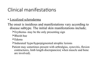 Comprehensive Overview of Juvenile Scleroderma: Diagnosis ...
