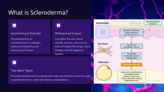 Scleroderma-Understanding-a-Complex-Autoimmune-Disease (1).pptx