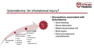 Scleroderma Lung Disease: Best Practices for Monitoring and Treatment | PPT