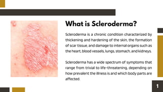 Scleroderma And Stem Cell Therapy - Dr. David Greene R3 Stem Cell | PPTX