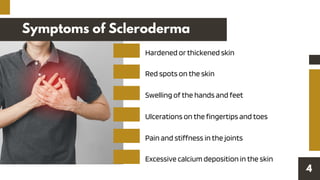 Scleroderma And Stem Cell Therapy - Dr. David Greene R3 Stem Cell | PPTX