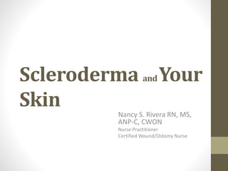 Scleroderma and Your Skin | PPT