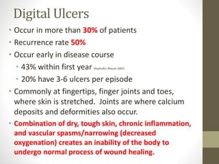 Scleroderma and Your Skin | PPTX