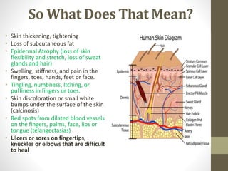Scleroderma and Your Skin | PPTX