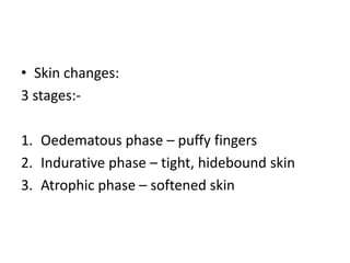 Scleroderma by aseem | PPTX