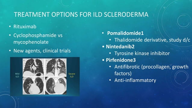 Current Advancements in Scleroderma Treatment | PPTX