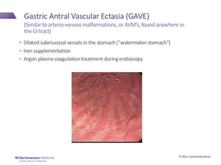 Scleroderma and the Gastrointestinal Tract and Gut Health | PPT