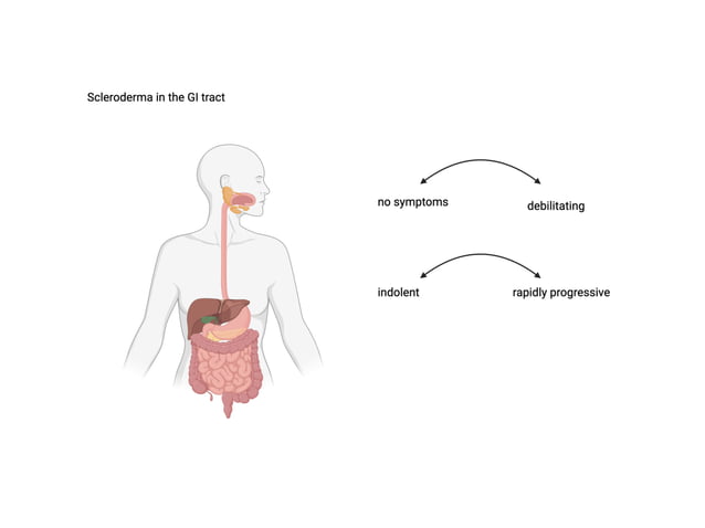 Scleroderma and the Gastrointestinal Tract and Gut Health | PPT