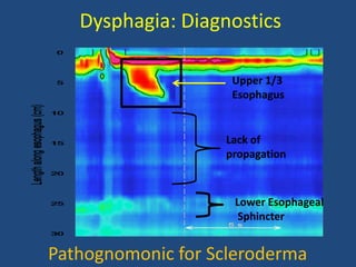 Scleroderma Esophagus