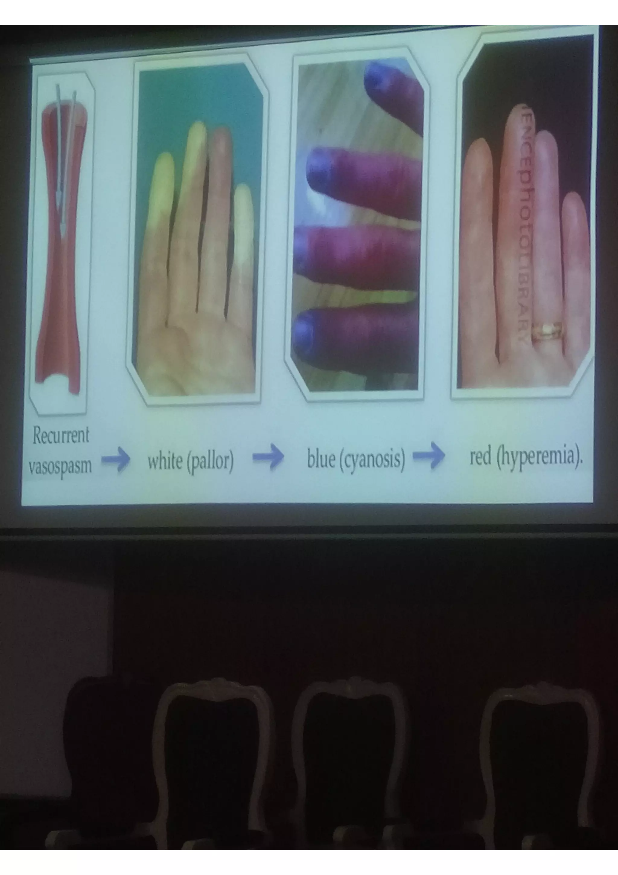 Scleroderma rheumatology 4.pdf