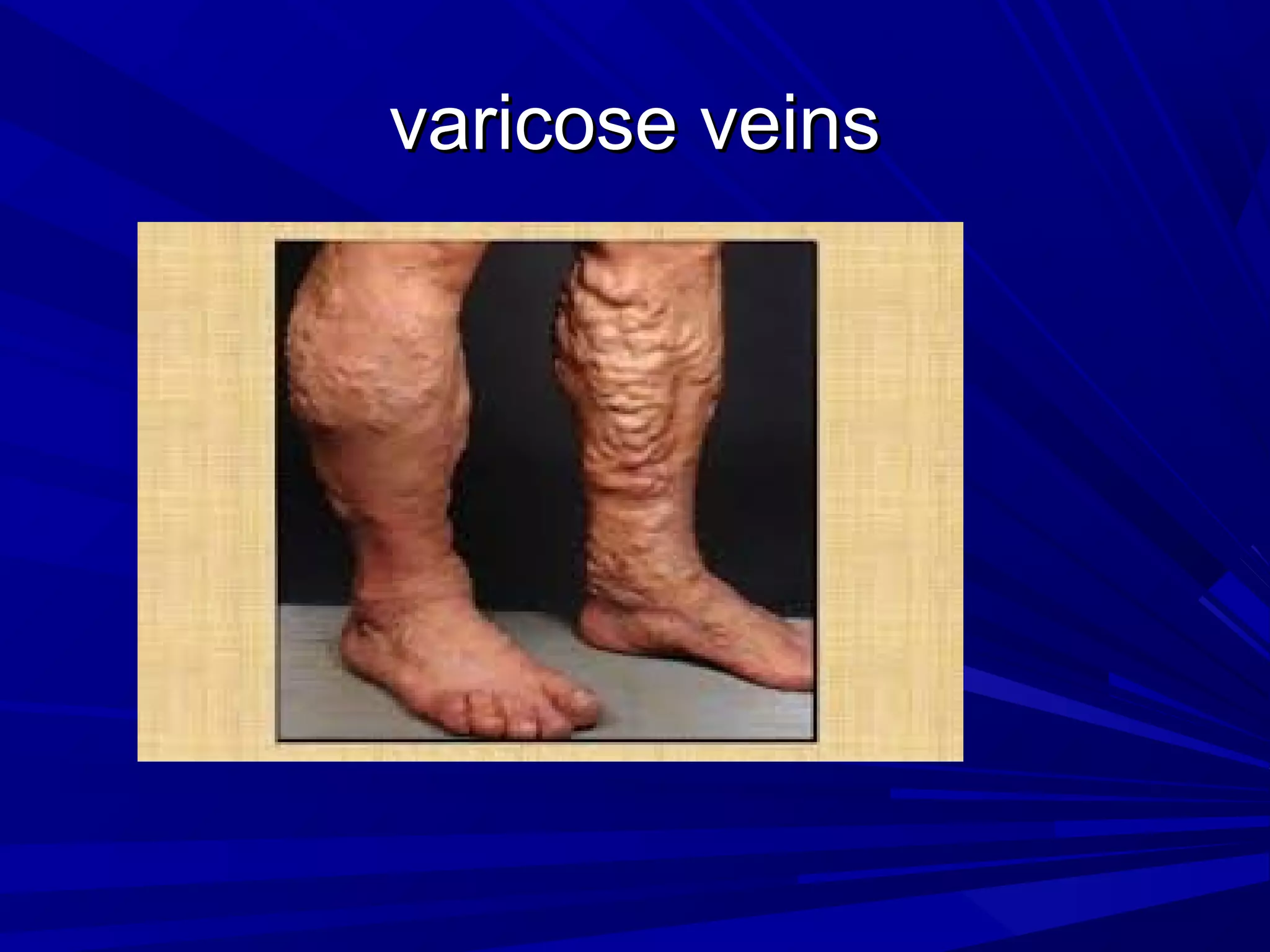 Sclerosing agents | PPT