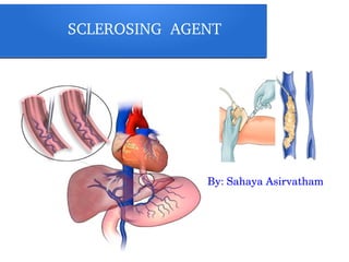 Sclerosing agents | PDF