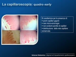 Sclerosi sistemica diagnosi ed inquadramento capillaroscopico | PPTX ...