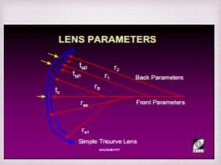 Various Soft Contact Lens- designs and their indications | PPTX