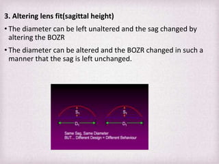 Various Soft Contact Lens- designs and their indications | PPTX
