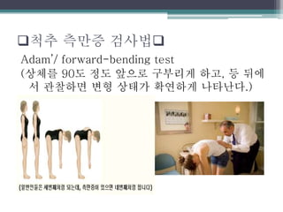 Scoliosis 도수운동치료 | PPTX
