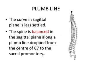 Scoliosis basics, classification | PPTX