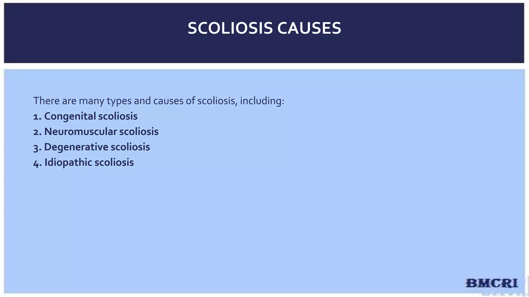 Scoliosis | PPTX