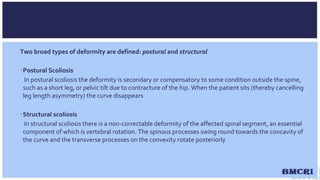 Scoliosis | PPTX