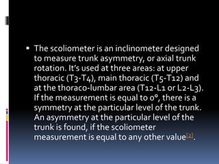 Scoliosis | PPTX