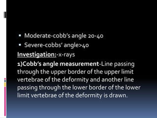 Scoliosis | PPTX