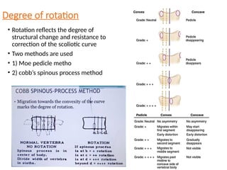 Scoliosis:-Definition,Diagnosis, Investigation, Types, Management | PPTX