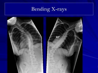 Case Presentation #8: 14 year old female presented with Adolescent ...