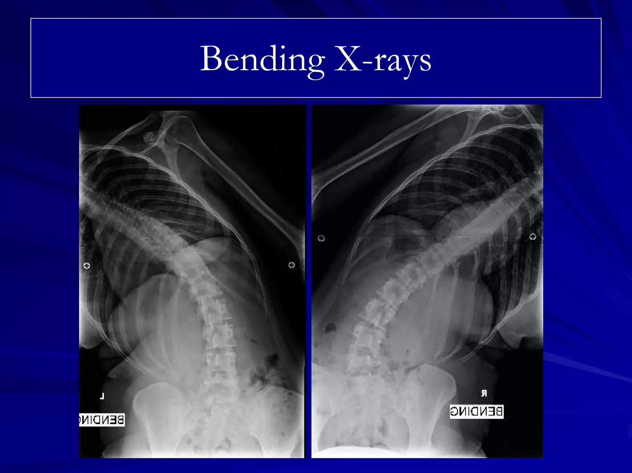 Case Review #14: 16 year old female with progressive adolescent ...