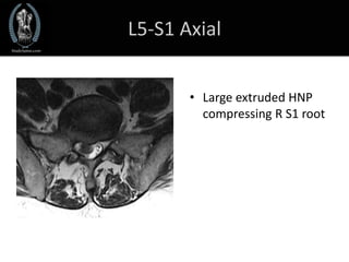 What do you find? | PPT