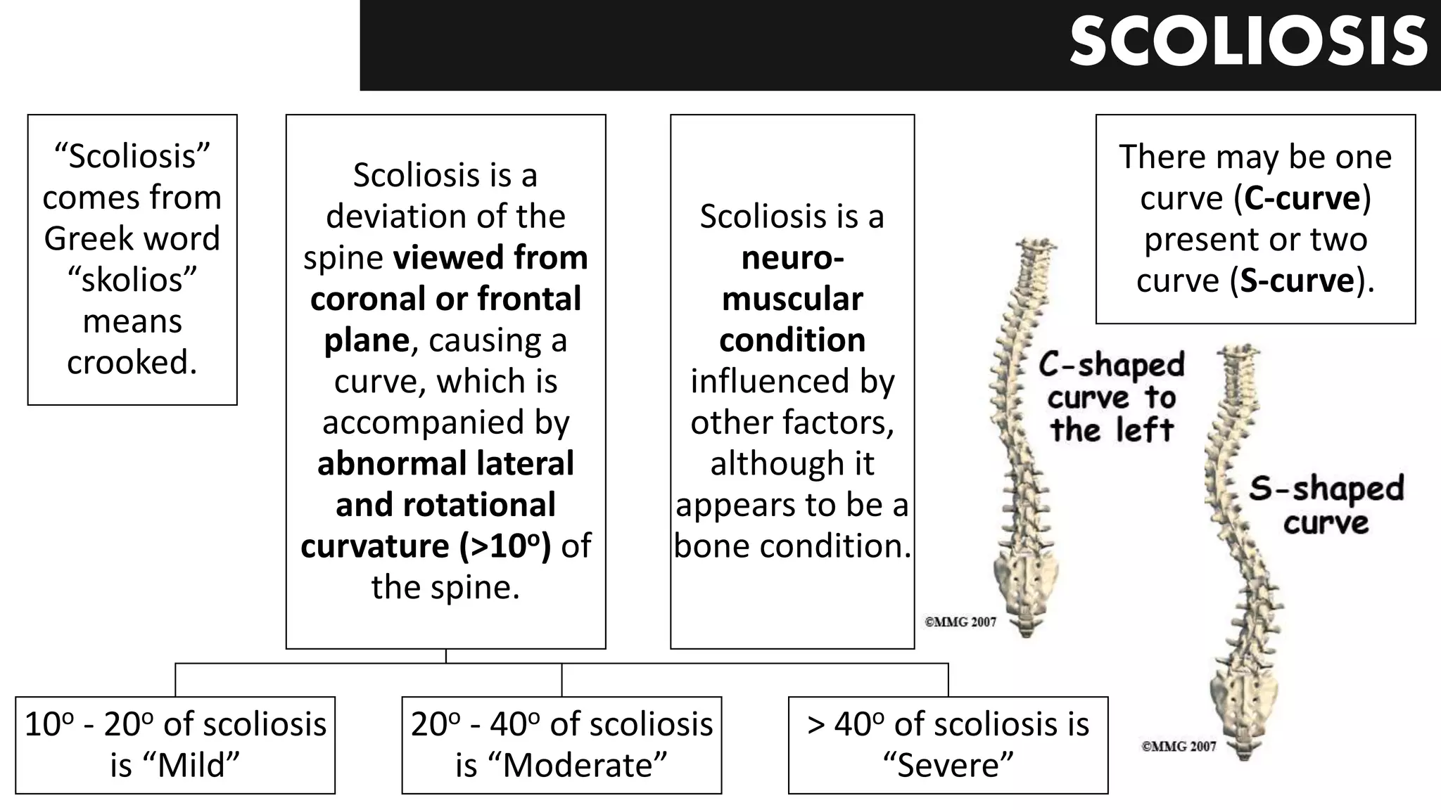 Scoliosis (Spine Disorder) | PPTX