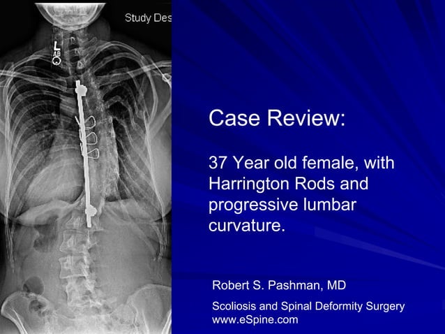 Case Review #28: Patient with Lumbar Scoliosis status post surgery with ...