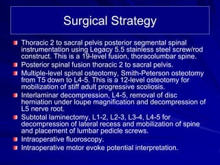 Case Review 15: Adult Scoliosis treated with Spinal Fusion and ...