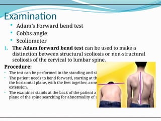 SCOLIOSIS Presentation, assessment, types and Treatment, Management | PPTX